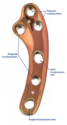 Bone Plates – BioMedtrix